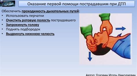 Оказание первой помощи пострадавшим при ДТП - online presentation