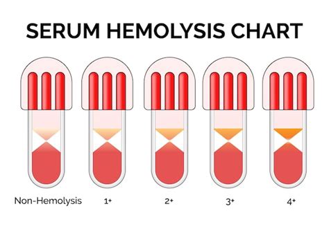 Premium Vector Serum Hemolysis Chart Vector Illustration Nonhemolysis