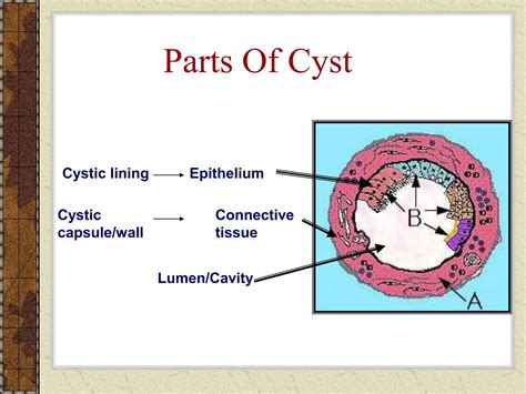 Cystsppt