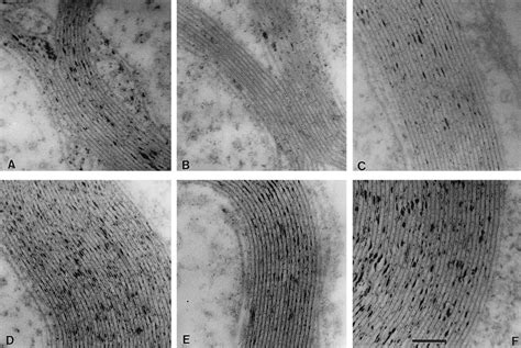 Electron Microscopy Of Cross Sections Of The Optic And Sciatic Nerve Of