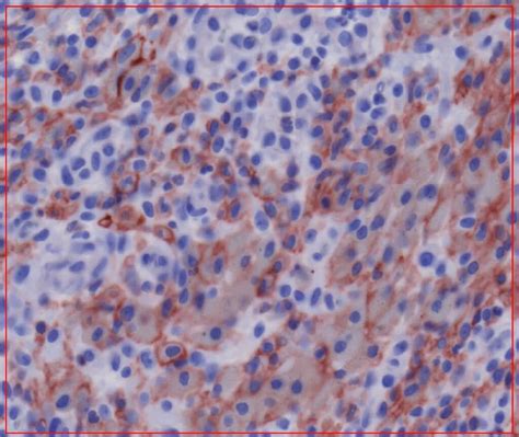 Positive Cell Detection False Positives Image Analysis Image Sc Forum