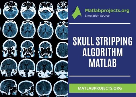 Performance Evaluation Of Skull Stripping Algorithm Matlab Programming