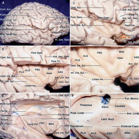 Right Cerebellar Hemisphere