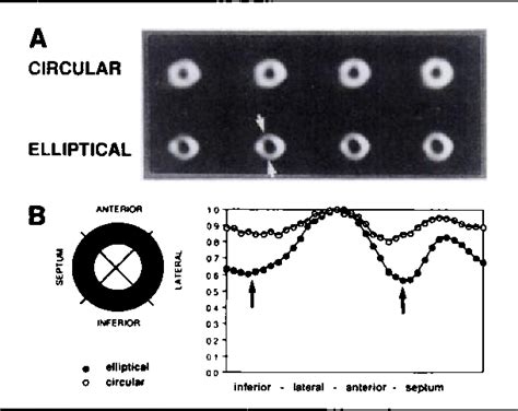 Figure 1 From Orbit Related Variation In Spatial Resolution As A Source Of Artifactual Defects
