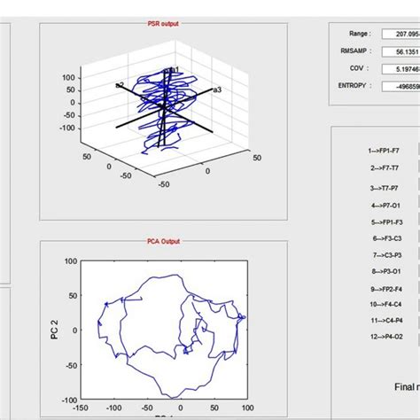 Block Diagram Of Patient Specific Seizure Detection Download Scientific Diagram