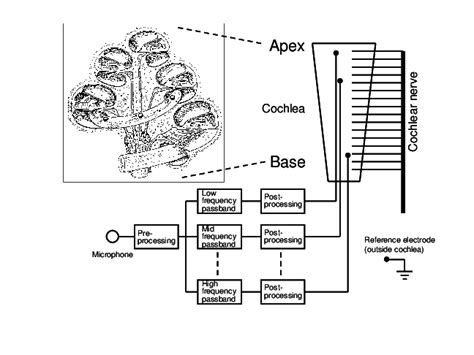 schematic diagram of a cochlear implant the diagram of the cochlear