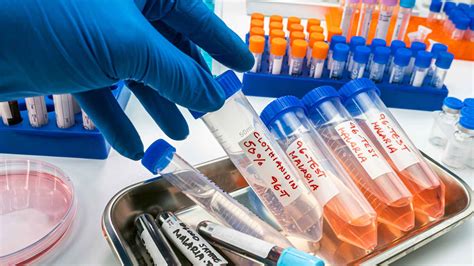 The Kirby Bauer Diffusion Method Da Ta Biotech