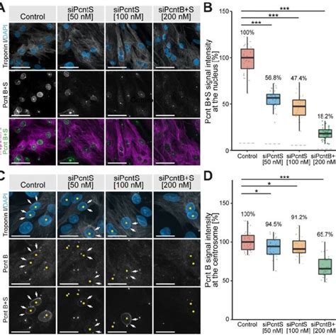 Effect Of Pcnt Depletion On Centriole Configuration A Representative