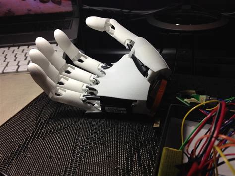 Youbionic The 3d Printed Robotic Controlled Prosthetic Hand Is One