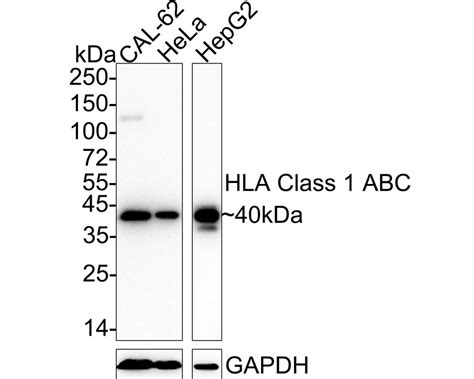 Hla Class 1 Abc Mouse Monoclonal Antibody 11c3 Em1801 09 Huabio