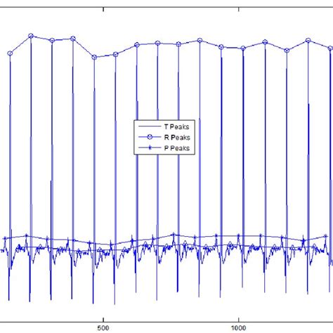 Pdf An Approach For Ecg Feature Extraction Using Daubechies 4 Db4 Wavelet