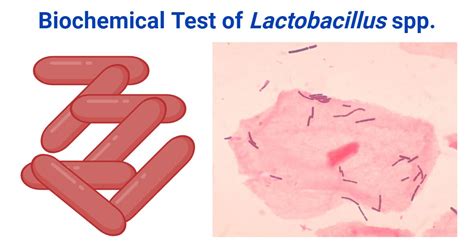 Biochemical Test Of Lactobacillus Spp