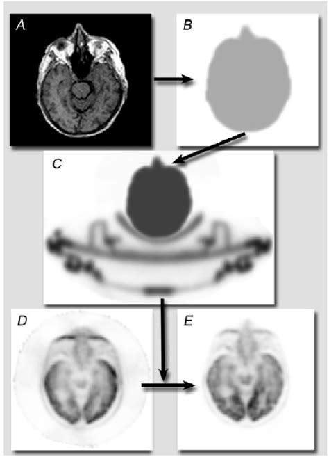 Schematic Representation Of The Attenuation Correction Process Adopted Download Scientific