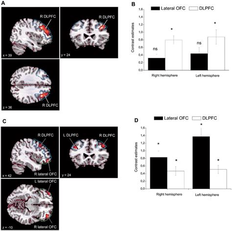 Statistical Parametric Maps Showing Activations During The Main Effect