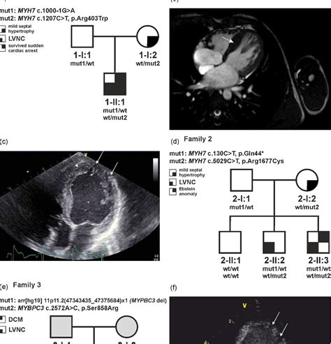 figure 1 from human mutation semantic scholar