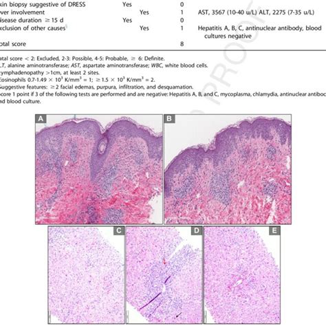 Patient With A Diffuse Morbilliform Rash Involving The Face With Edema Download Scientific