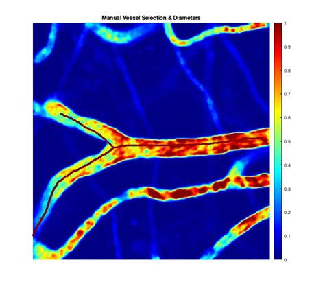 Extracting Vessel Dimensions From 2d Fluorescence Microscopy Images In Matlab Stack Overflow