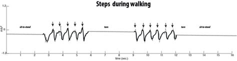 Representation Of An Ap Acceleration Signal For Detecting Steps During