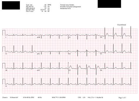 Borderline Ecg A 12 Lead Electrocardiogram Ecg On Presentation