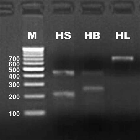 Molecular Differentation Of Hypoderma Spp By Pcrrflp M Marker 100 Download Scientific
