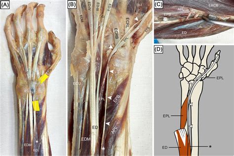 Dissection A C And Schematic Illustration D Of The Variant Extensor Download Scientific