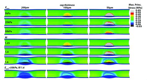 longitudinal cut of idealized models with varying ri ecore and cap