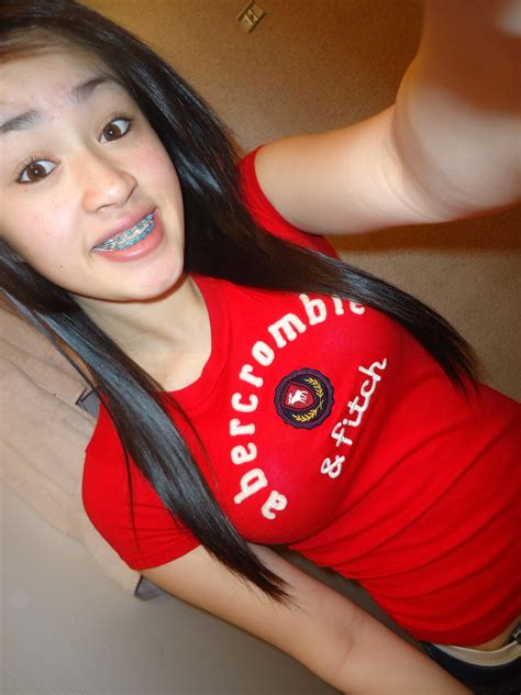 Braces Fetish On Tumblr