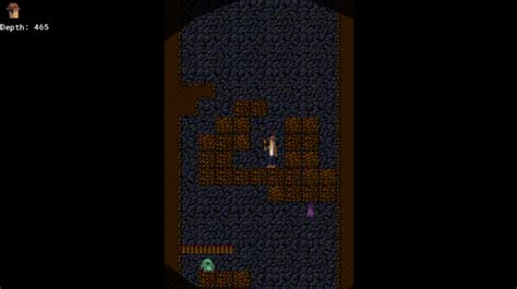 IXgl Zm Imgur Steven Splint