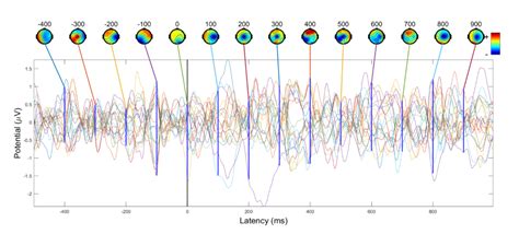QEEG Brain Mapping Colorado Springs Neuro Hope Neurofeedback
