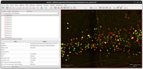 Adding A New Measurement In Qupath Table Image Analysis Imagesc Forum