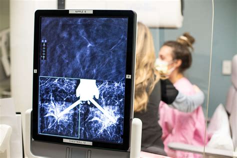 Underutilized Mammogram Data Could Help Identity Cancer Risk Linked To Breast Density