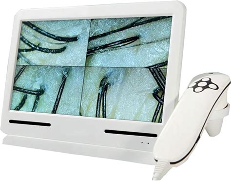 Suzlazyr Scalp Analysis Machine 10 Inch Professional Skin Diagnosis Hair Analyzer Suzlazyr Scalp Analysis Machine 10 Inch Professional Skin Diagnosis Hair Analyzer