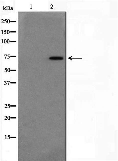 Dusp16 Polyclonal Antibody Pa5 99255