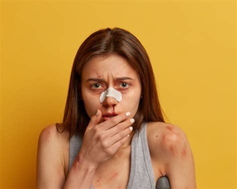 علائم شکستگی بینی دکتر هومن هوشنگی