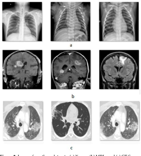 Figure 2 From Digital Watermarking As An Adversarial Attack On Medical Image Analysis With Deep