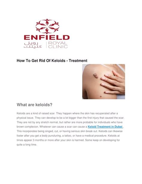 PPT How To Get Rid Of Keloids Treatment PowerPoint Presentation Free Download ID 11669953