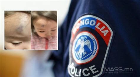 ЦЕГ Охинд гэмтлийн зэрэг тогтоогдвол эрүүгийн хэрэг нээж шалгана