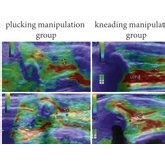 Ultrasonic Elastic Evaluation A The Top And Bottom Rows Show The Download Scientific Diagram