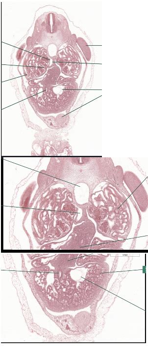 Lab 6 Slide 6 Diagram Quizlet
