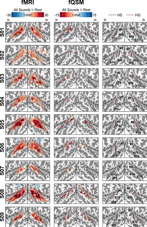 Activation Maps Overlaid Onto The Inflated Cortical Surface Mesh Of Download Scientific Diagram