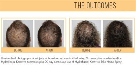 Maintaining A Healthy Scalp Hair For Improved Hair Growth Maningas Cosmetic Surgery