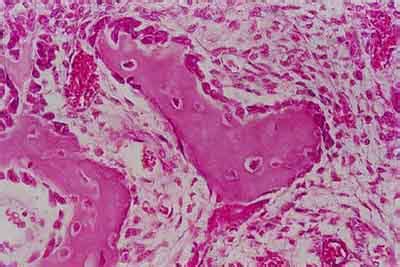 Histology World Audio Histology Slide Immature Bone