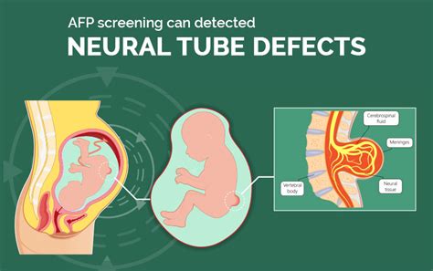 Get AFP Blood Test In Flexible Cost In Kolkata Accuhealth Diagnostics