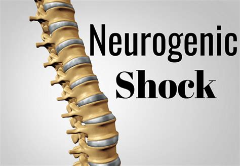 Neurogenic Shock Causes Signs And Nursing Management
