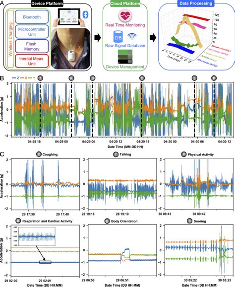 Automated Multiparametric Monitoring Of Respiratory Biomarkers And Vital Signs In Clinical And