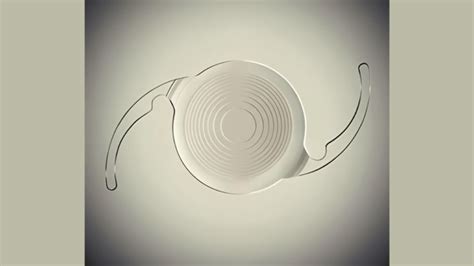 Multifocal Iol Cost Benefits And Side Effects Explained 2025