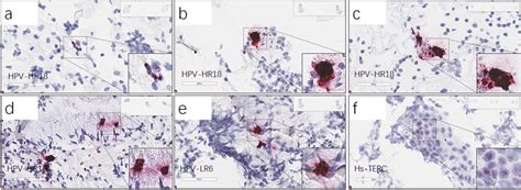 Rnascope Hpv Hr18 Hpv Lr6 And Hs Terc Representative Images A F Download Scientific Diagram