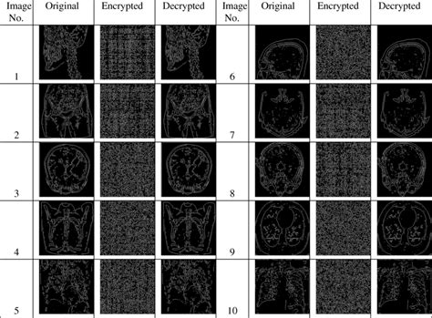 Visual Edge Detection Findings Of Color And Gray Medical Images Download Scientific Diagram