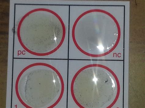Rapid Plasma Reagin Rpr Test Universe84a