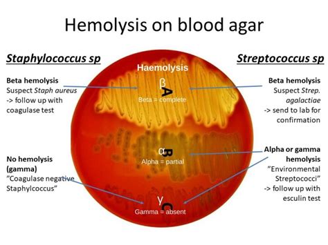 Module 12 4 Special Biochemical Tests For Further Differentiation Of